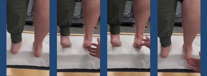 Heel Pain Holding You Back? - Achilles Tendinopathy: Causes, Stages ...
